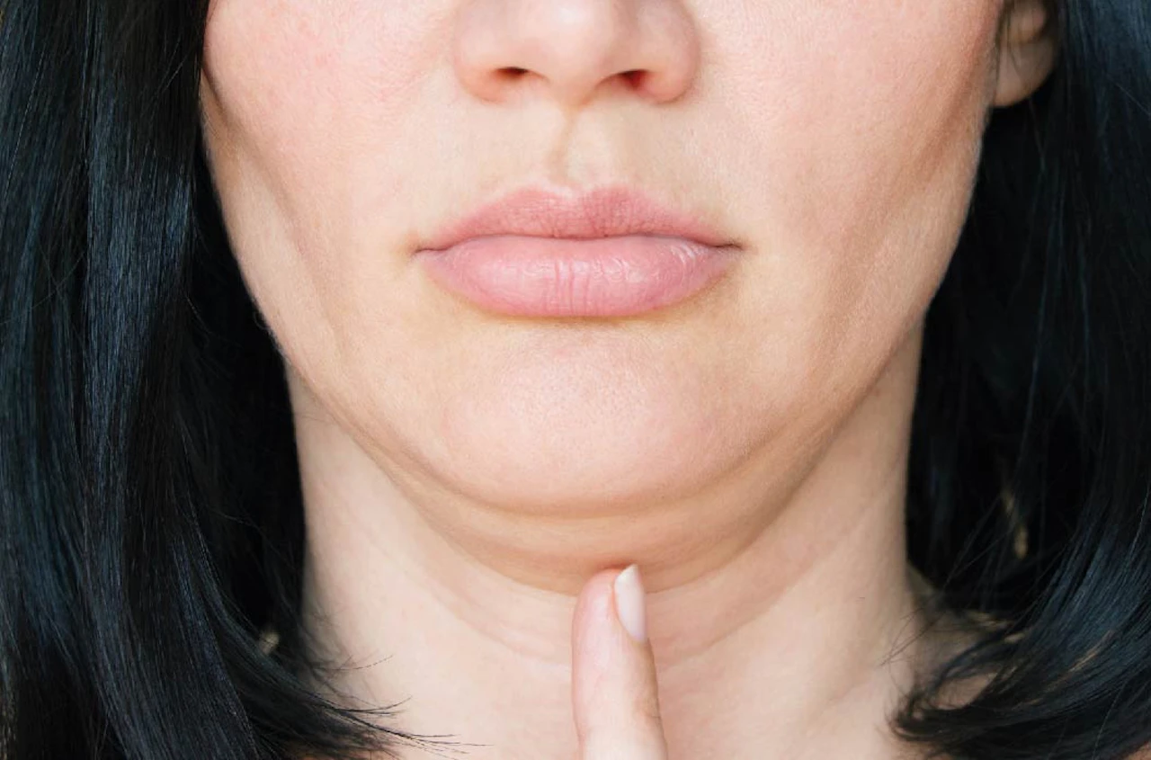 How to get rid of a double chin | MYA Cosmetic Surgery