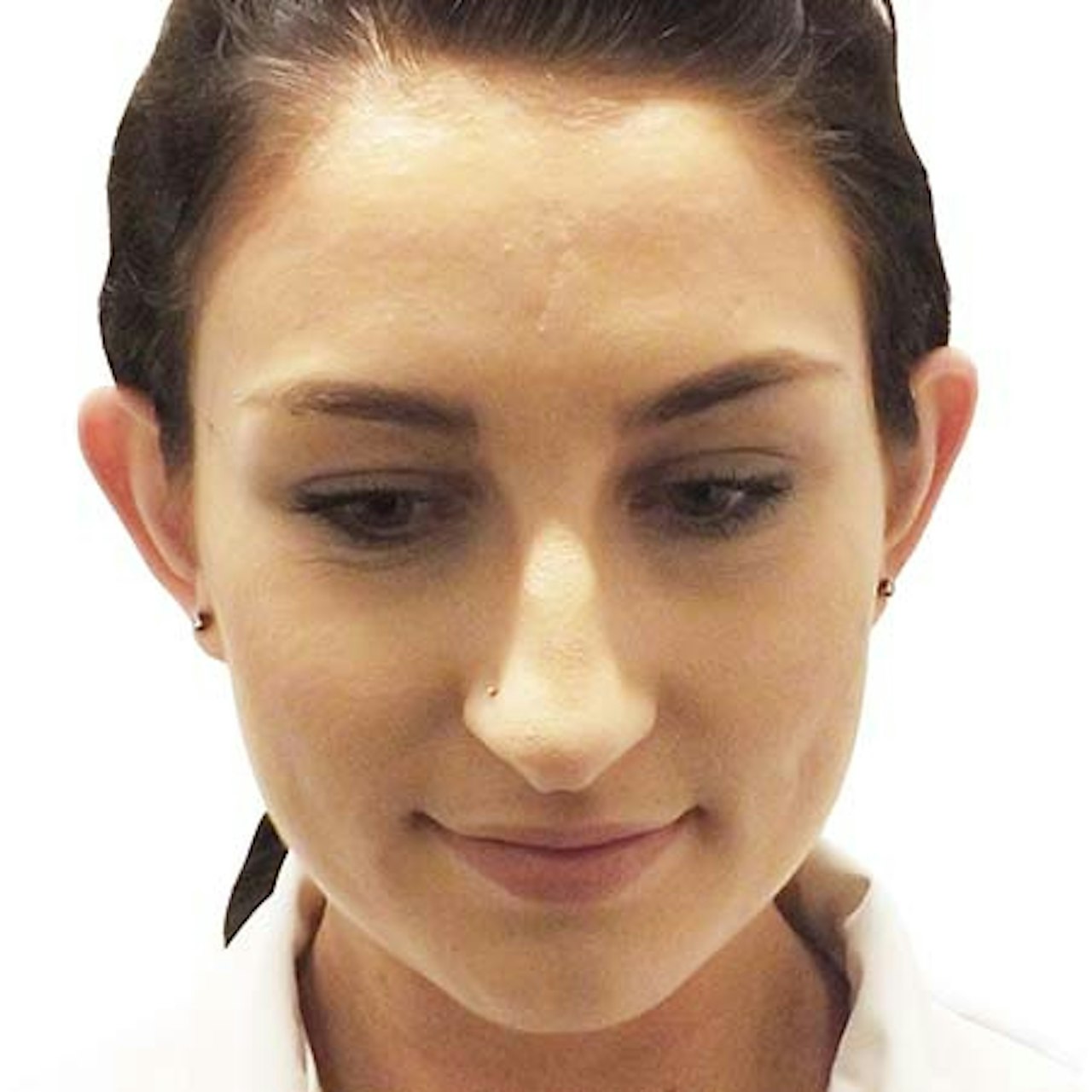 Ear Reshaping | Otoplasty | Ear Surgery | MYA Cosmetic Surgery